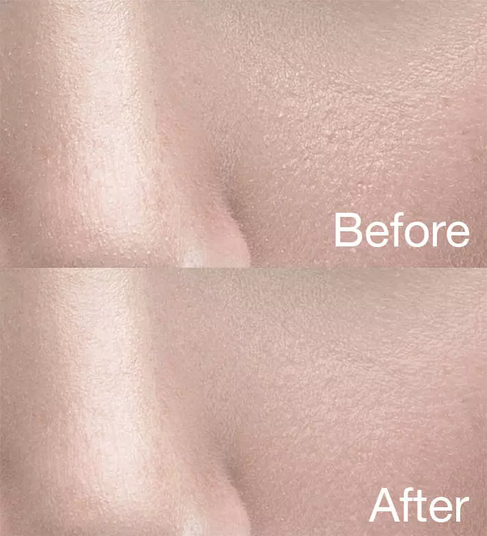 Fstoppers-Woloszynowicz-Smoothing-Skin-Texture-Before-After