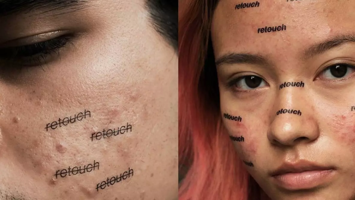 Fotograaf probeert acne te normaliseren met niet-geretoucheerde reeks foto's